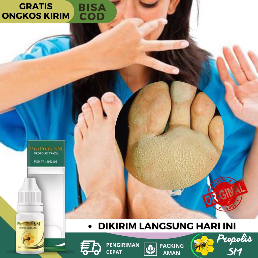 Jual Obat Kaki Rayapan, Obat Kaki Rayapan Dan Bau, Obat Kaki Rayapan ...