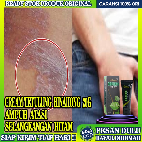 Jual Salep Selangkangan Hitam dan Gatal,Salep Obat Gatal Jamur ...