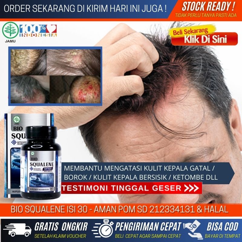 Jual Obat Untuk Kulit Kepala Gatal, Mengobati Dermatitis Seboroik Di Kepala, Menghilangkan ...