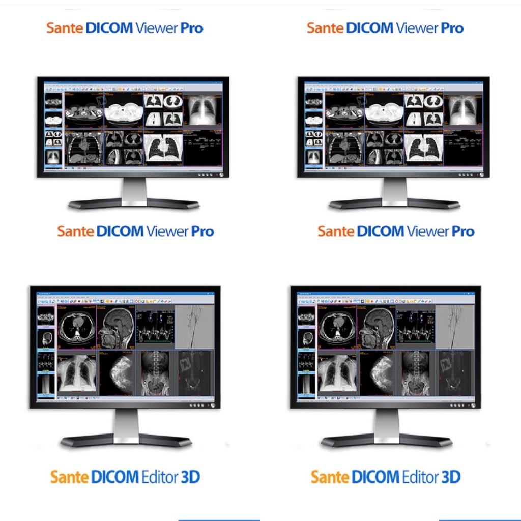 Jual [work]Sante Dicom Viewer 3D Pro2023 Sante Dicom 3D Editor Pro ...
