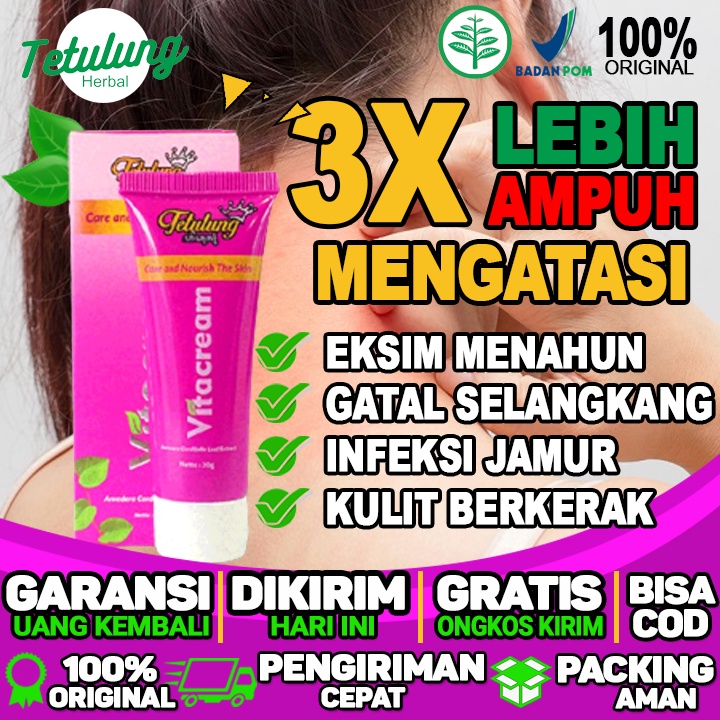 Jual Obat Cream Untuk Gatal Di Selangkangan Krim Untuk Menghilangkan ...