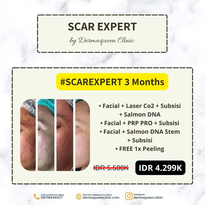 Jual SCAR PACKAGE (Bebas Bopeng) | Shopee Indonesia
