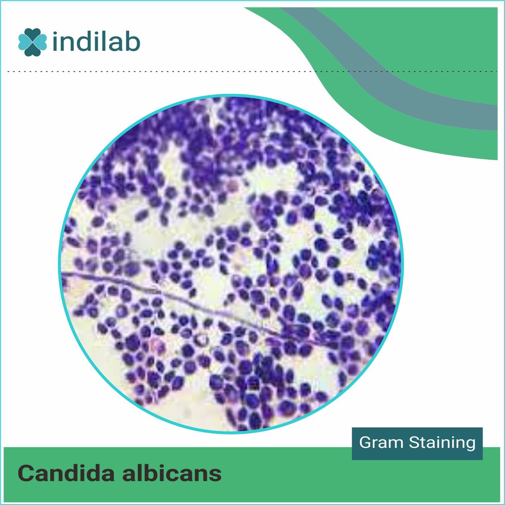 Jual Kultur Isolat Murni Jamur Candida albicans | Shopee Indonesia