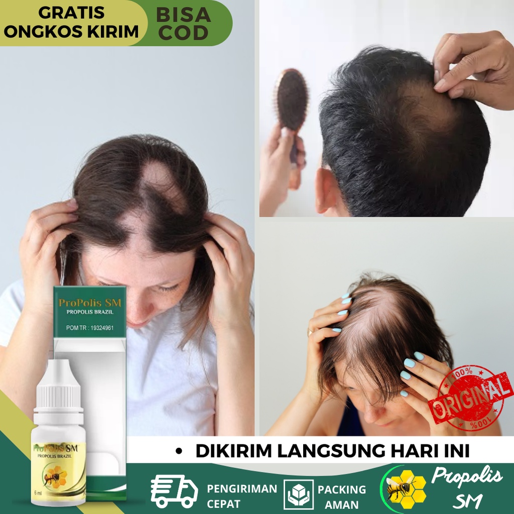 Jual Obat Alopecia Areata, Obat Penyakit Autoimun, Obat Penumbuh ...