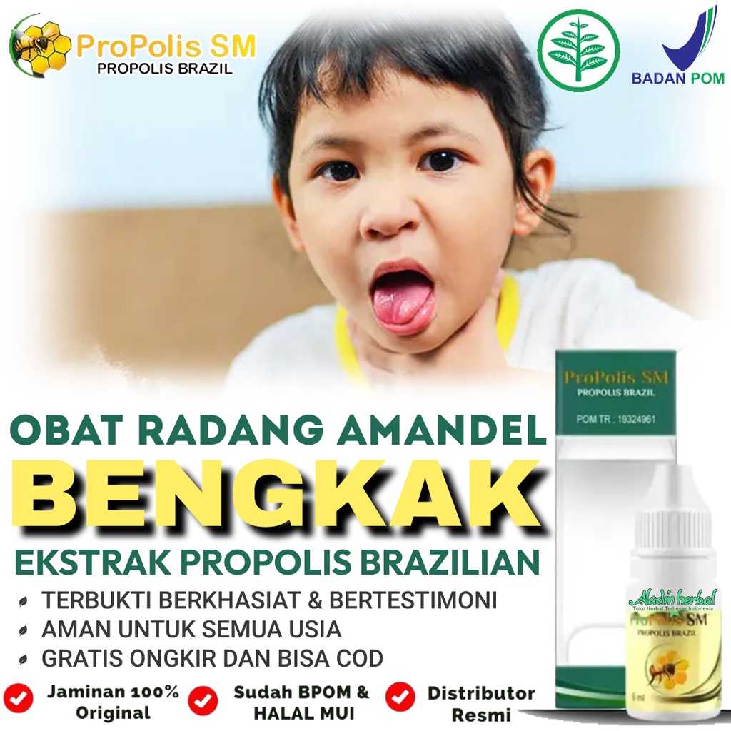 Jual Obat Amandel Anak Dan Dewasa, Radang Amandel, Amandel bengkak - Propolis Brazilian SM ...