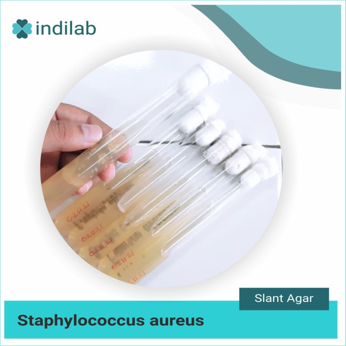 Jual KULTUR ISOLAT BIAKAN MURNI BAKTERI S. AUREUS STAPHYLOCOCCUS AUREUS ...