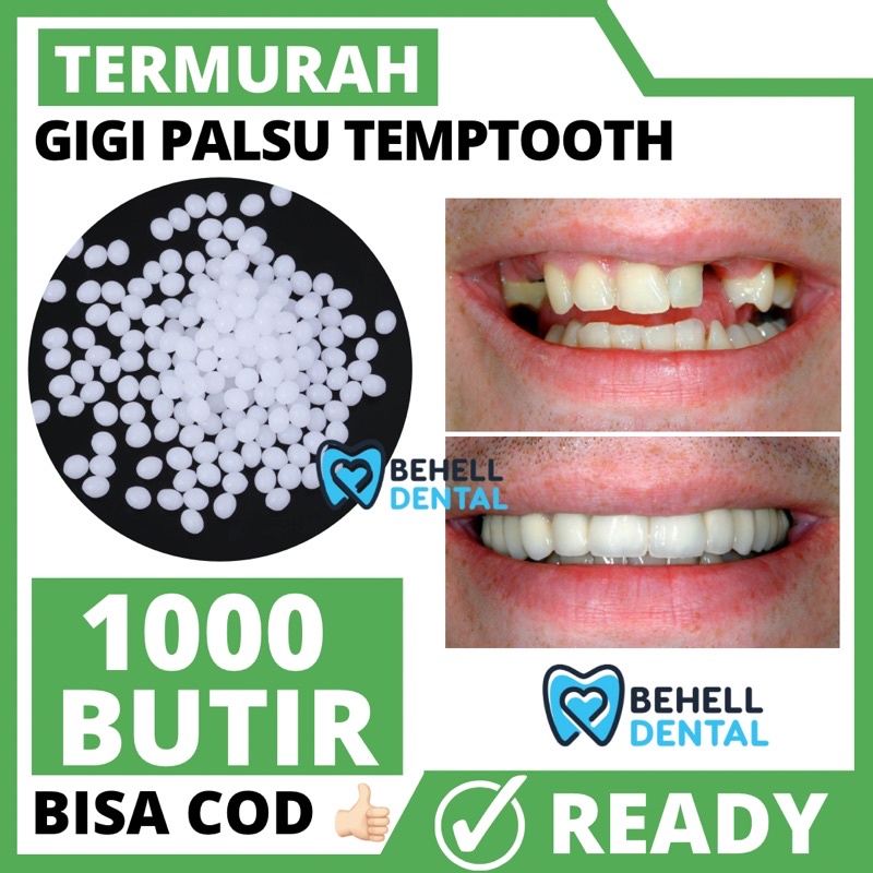 Jual TERMURAH !! 1000 BUTIR TEMPTOOTH GIGI PALSU SEMENTARA PENAMBAL ...
