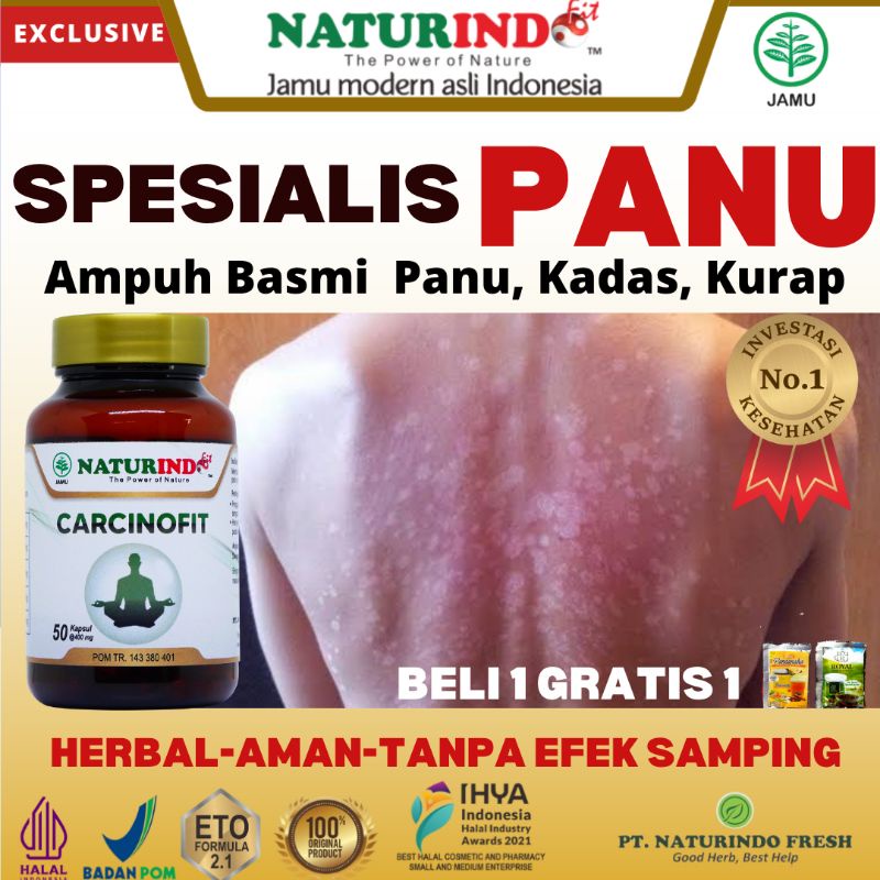 Jual Obat Penghilang Panu Kadas Kurap Menahun Kudis Exsim Panuan ...