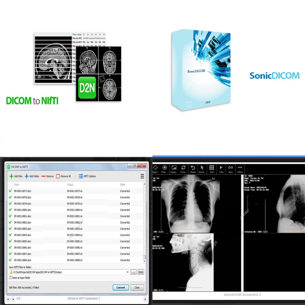 Jual [Work]SonicDicom Dicom to NifTI Alat menejemen Tampilan Pertukaran Gambar Medis Garansi ...