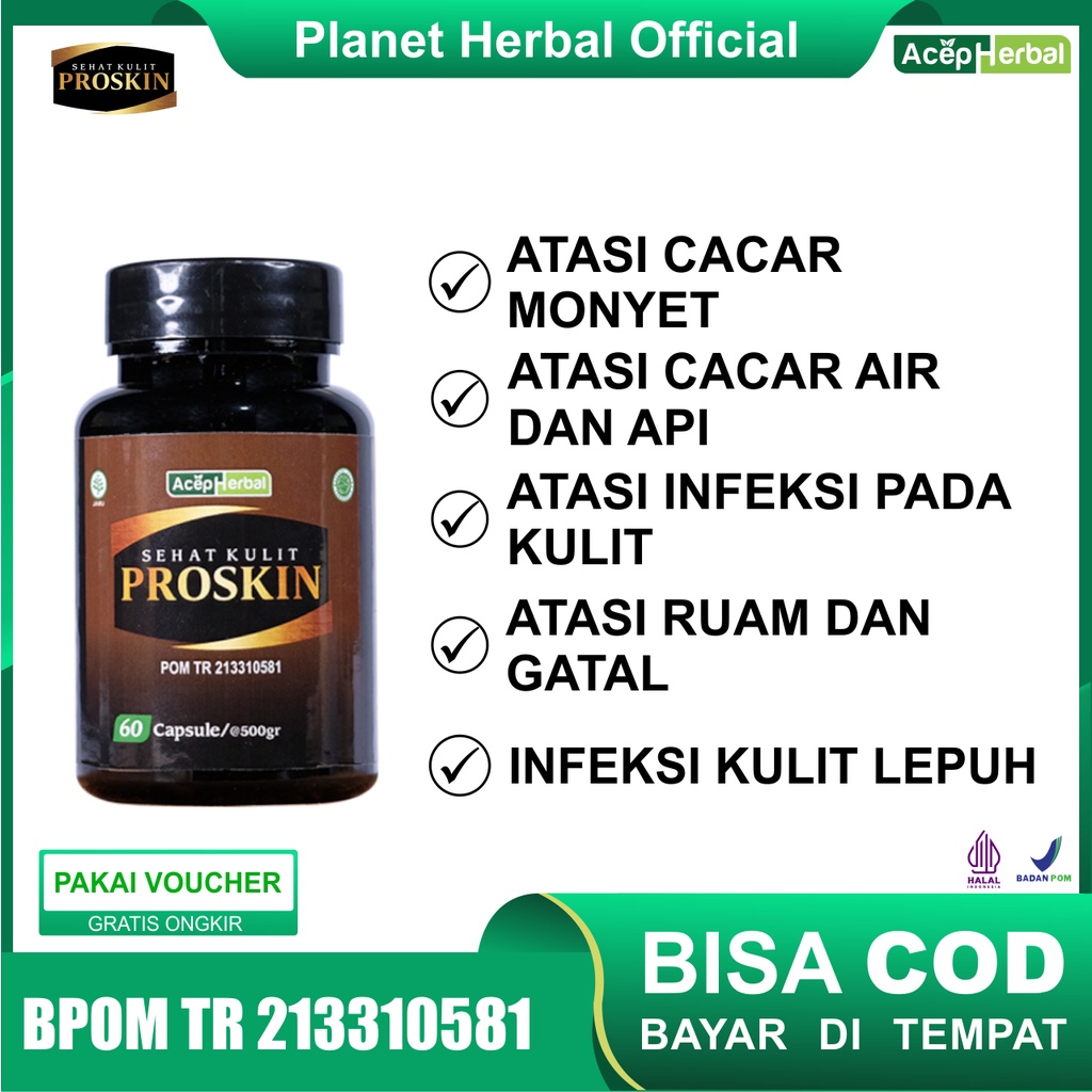Jual Obat Cacar Monyet Air Api Infeksi Virus Sehat Kulit Proskin Solusi ...