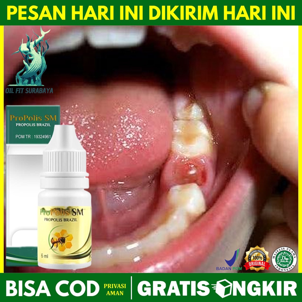 Jual Obat Sakit Gigi Berlubang Gusi Abses Gusi Bengkak Untuk Pria ...