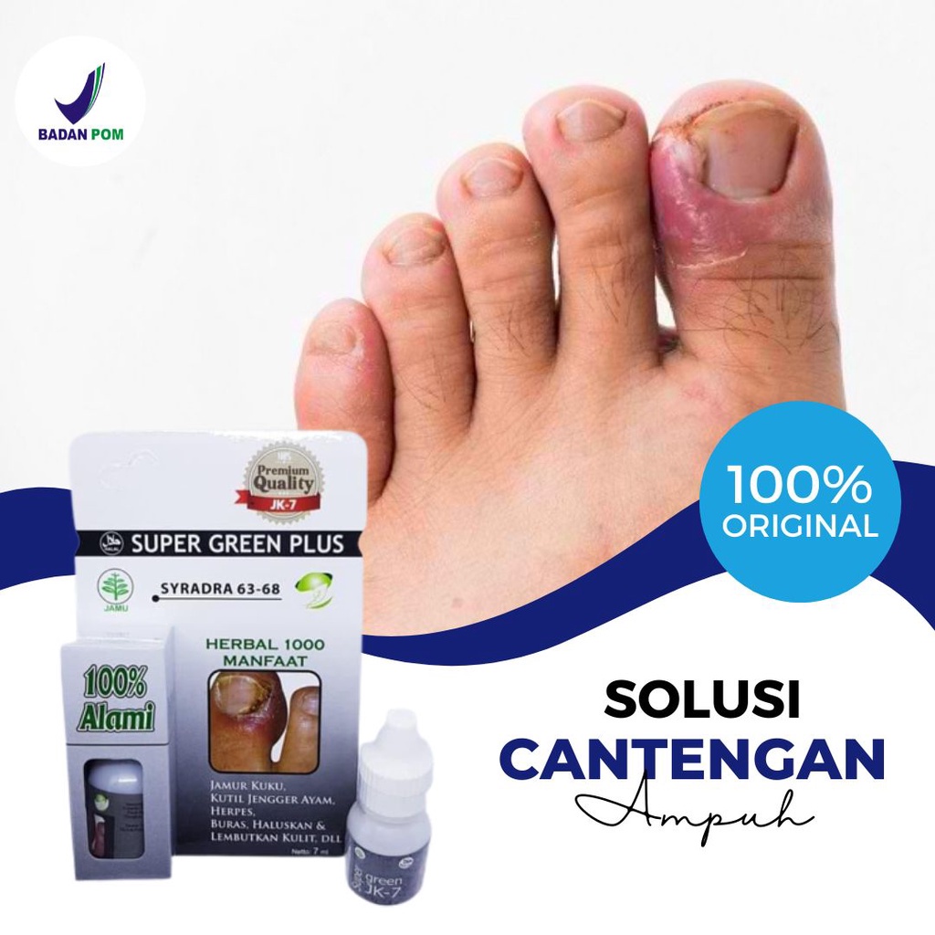 Jual Obat Kuku Busuk Dan Hitam - Obat Cantengan Jempol Kaki Kuku Jamur ...