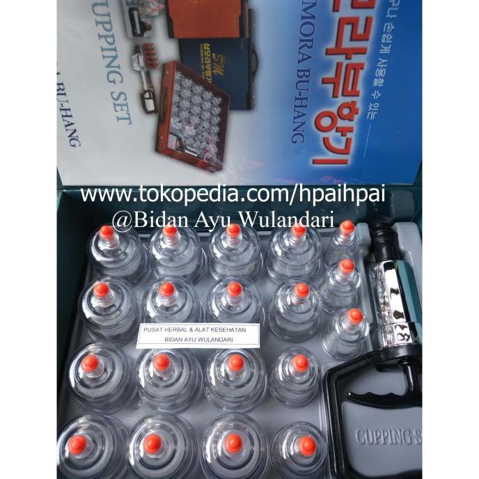 Jual Alat Bekam Sammora Box Biru Isi 19 Kop Buatan Korea | Shopee Indonesia