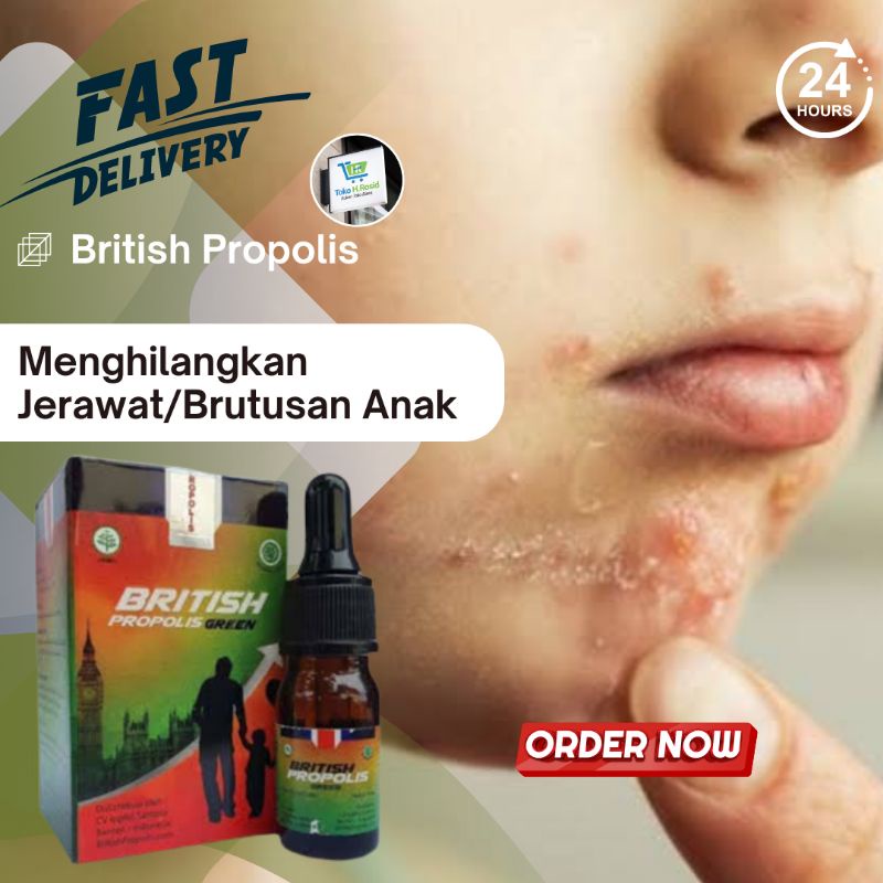 Jual British Propolis 6ml Obat Herbal Jerawat Anak Punggung Batu Salep ...