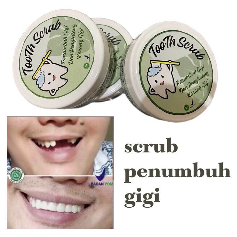 Jual PENUMBUH GIGI ALAMI - GIGI OMPONH TERTAMBAL LAGI // GIGI PATAH ...