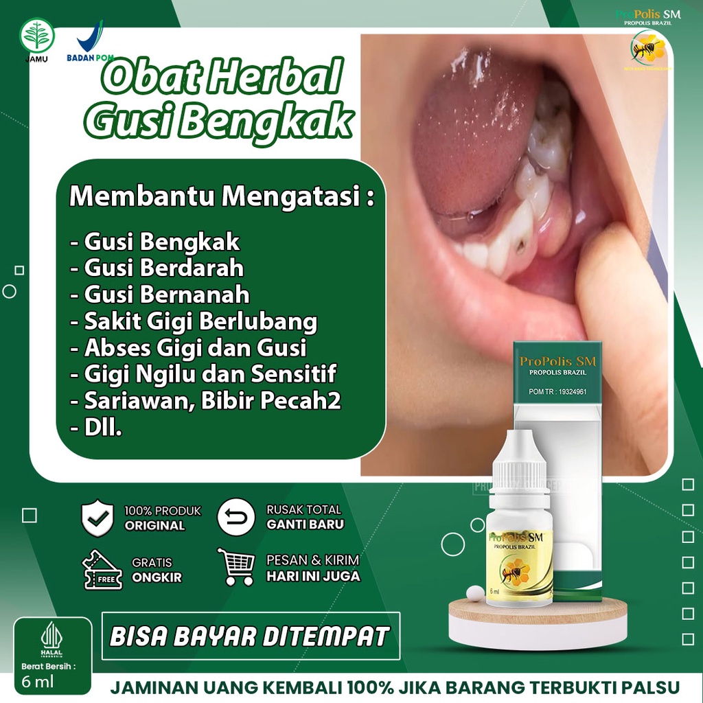 Jual Obat Gusi Bengkak Gusi Berdarah Gigi Berlubang Abses Gigi Gusi ...