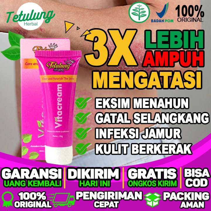 Jual Cream Untuk Menghilangkan Bekas Luka Gatal Krim Untuk Gatal Celah ...