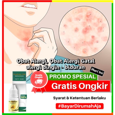Jual Obat Alergi, Obat Alergi Gatal, Obat alergi dingin, Obat alergi ...