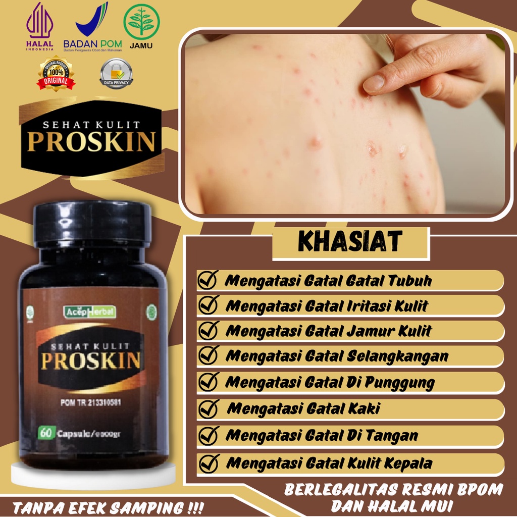 Jual Kapsul Proskin Obat Gatal Gatal Di Kulit Gatal Gatal Karena Jamur ...