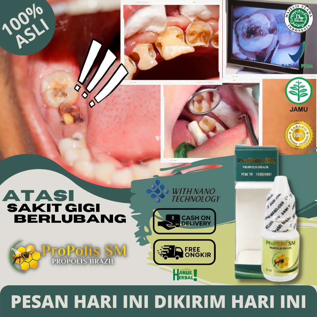Jual Obat Kumur Sakit Gigi Berlubang Gusi Bengkak dan Bau Mulut Dengan ...