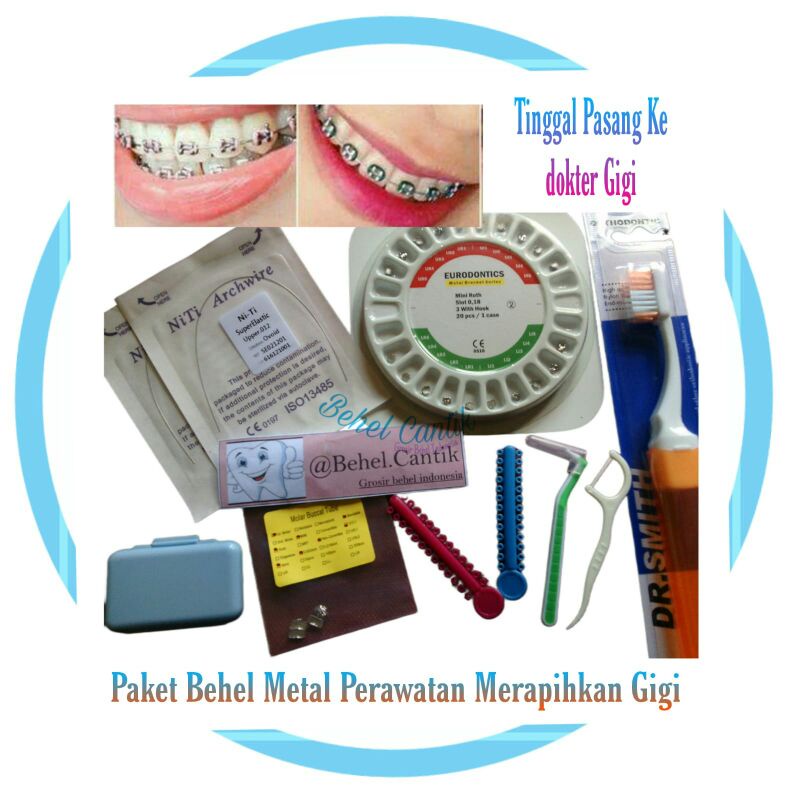 Jual 1Paket Behel Gigi Atas Bawah Pasang Sendiri Lengkap Untuk ...