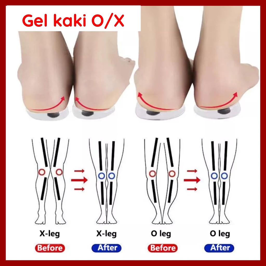 Jual INSOLE GEL SILIKON KAKI O/X SOL SEPATU PERBAIKI KAKI O/X PRIA ...