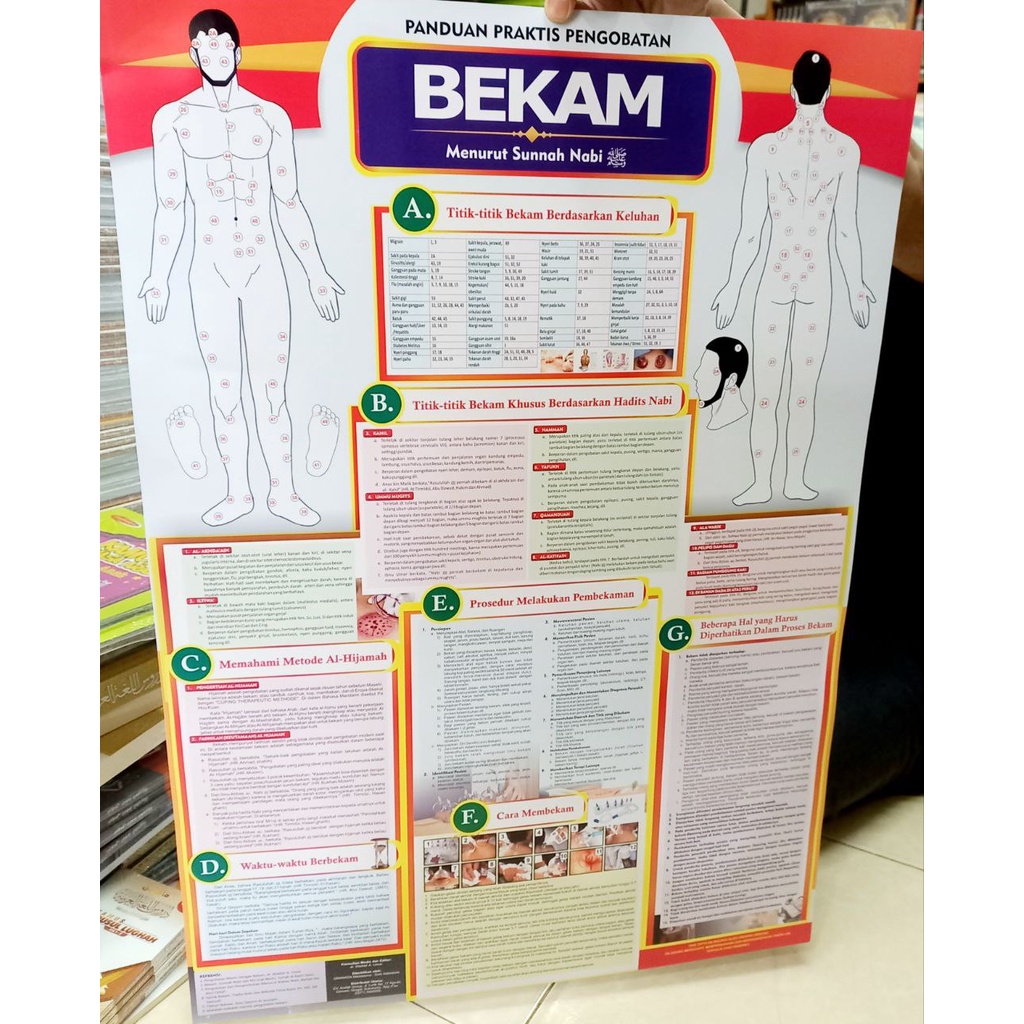 Jual Poster Panduan Praktis Pengobatan Bekam - Poster Bekam | Shopee ...