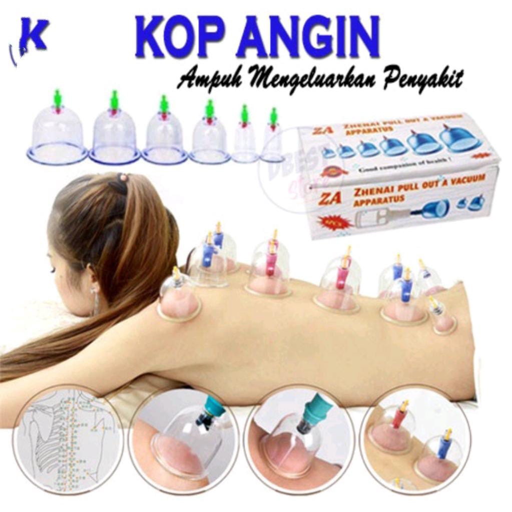 Jual Kop Angin Bekam Lengkap Isi 6 Cup Mengobati Masuk Angin dan Kesehatan Badan | Shopee Indonesia