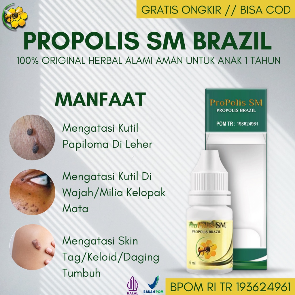 Jual Obat Penghilang Kutil Papiloma Skintag Kutil Di Kelamin Pria ...
