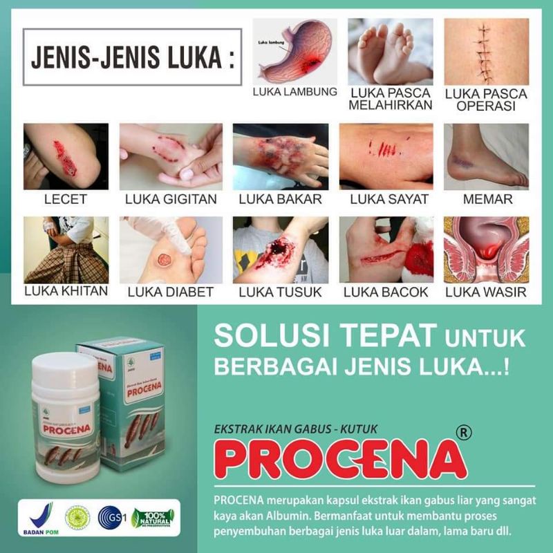 Jual PROCENA Ekstrak Ikan Gabus (ikan kutuk) | Shopee Indonesia