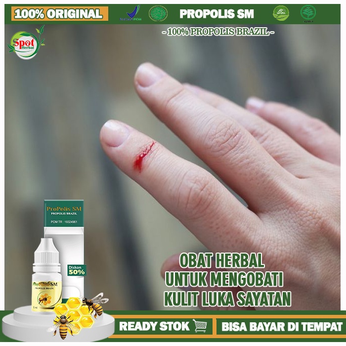 Jual Obat Pengering Luka Sayatan, Luka Sayatan Bekas Operasi, Obat ...