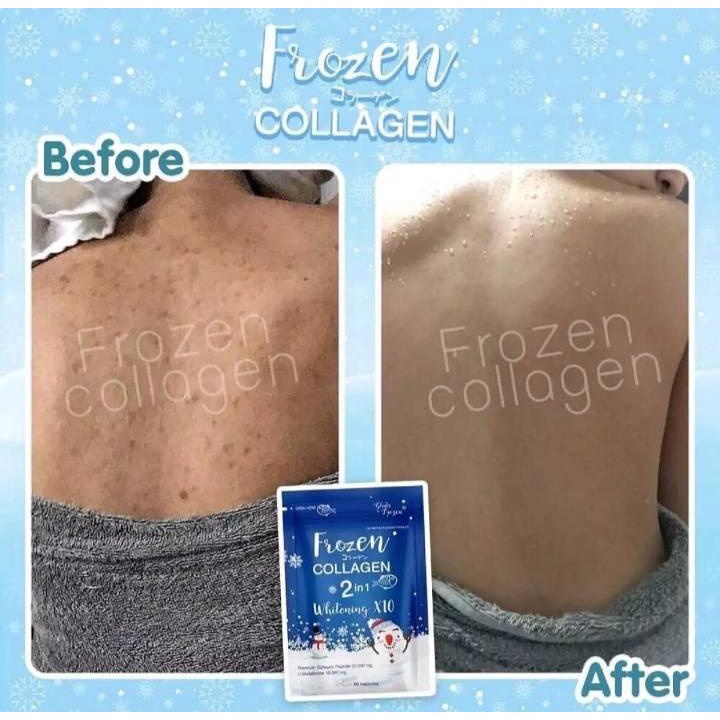 Jual Frozen Collagen 2 in 1 whitening x10 Original Thailand 100% ...