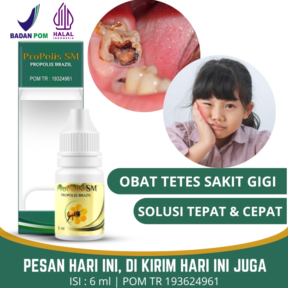 Jual Obat Tetes Sakit Gigi Berlubang Anak, Sakit Gigi, Nyeri Gigi Anak ...