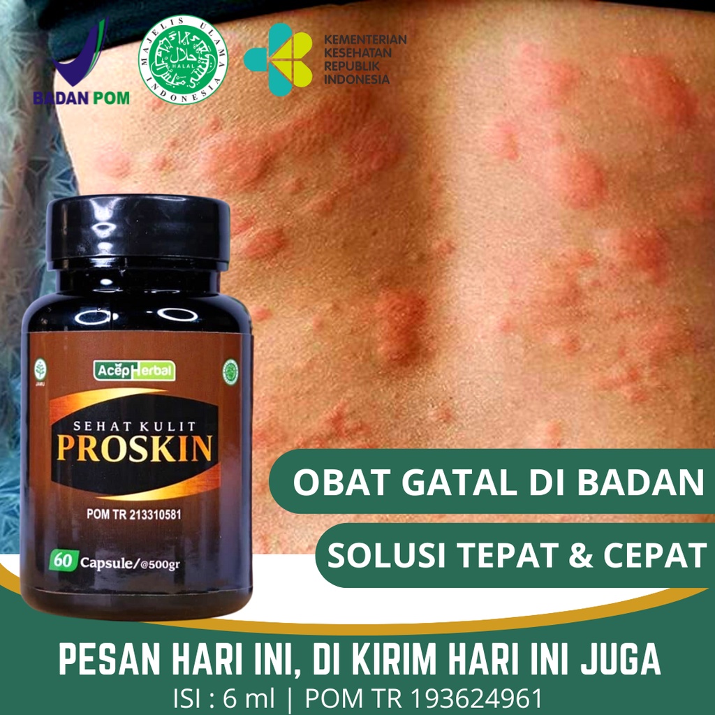 Jual PROSKIN Obat Kulit Gatal Seluruh Badan Kaligata Proskin Kapsul ...