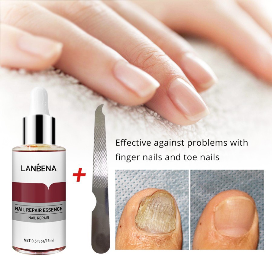 Jual Lanbena Nail Repair Essence Serum Perawatan Jamur Kuku Lanbena ...