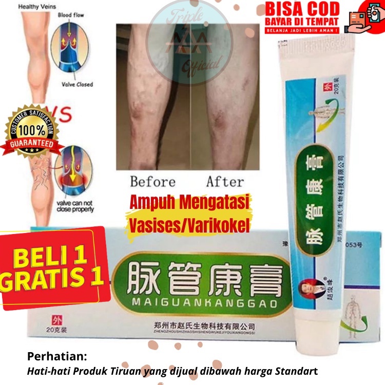 Jual TRIPLE A - Salep Varises Obat China Cina Maiguankanggao Original ...