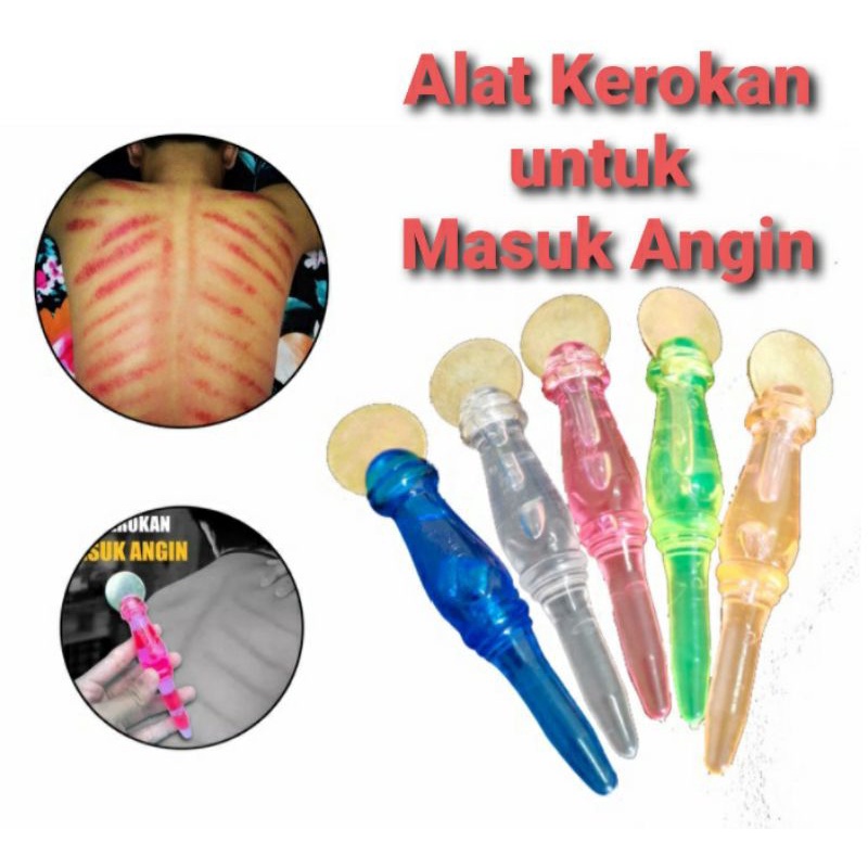 Jual Alat Kerokan Koin & Totok 2in1 / Kerok Kerikan Badan Untuk Masuk ...