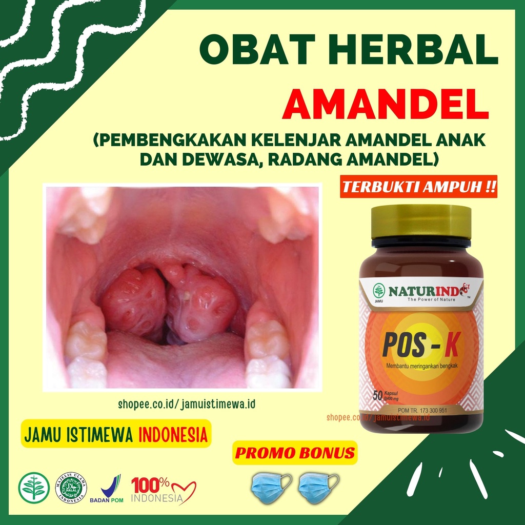 Jual Obat Amandel Paling Ampuh untuk Anak dan Dewasa Herbal Obat Bengkak Amandel Radang ...