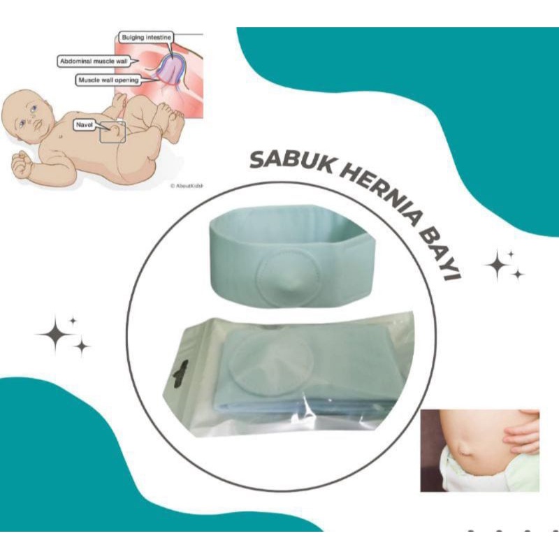 Jual Sabuk Hernia Bayi (Pusar Bodong) | Shopee Indonesia