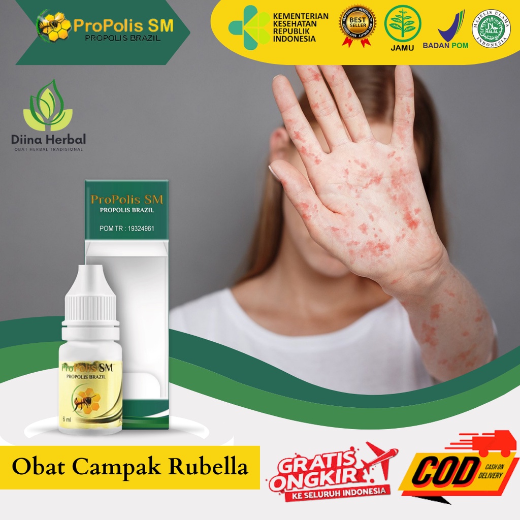 Jual Obat Campak, Obat Penghilang Bekas Campak, Obat Campak Untuk Anak ...