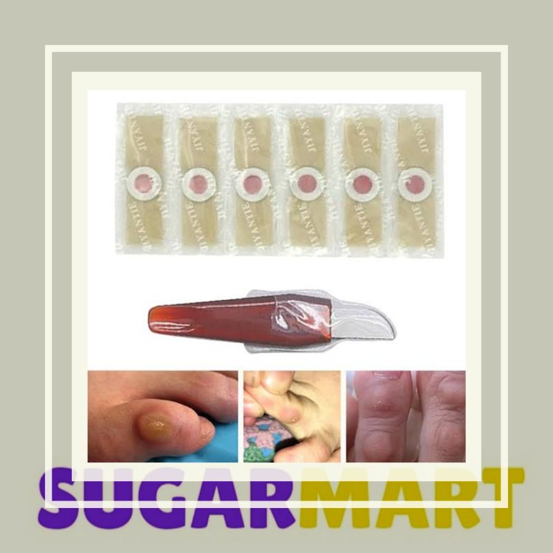 Jual Plester Kutil Mata Ikan isi 6pc Foot Corn Removal | Shopee Indonesia