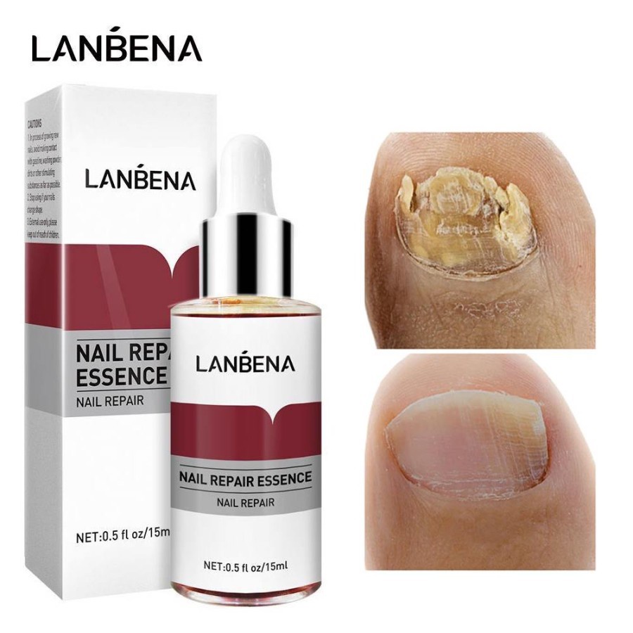 Jual Lanbena Nail Repair Essence Serum Perawatan Jamur Kuku Lanbena ...