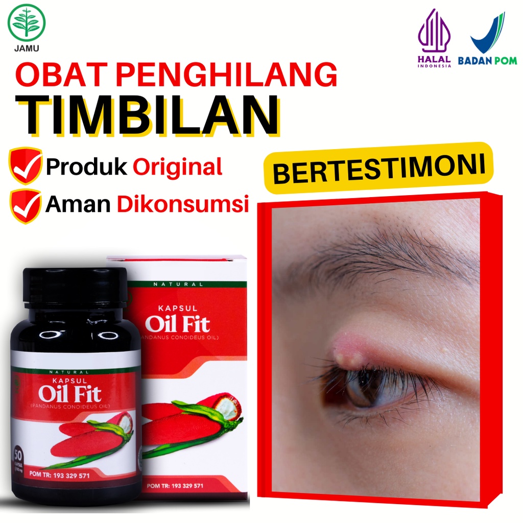 Jual Obat Timbilen Benjolan di Kelopak Mata Timbilan Pengempis Kalazion ...