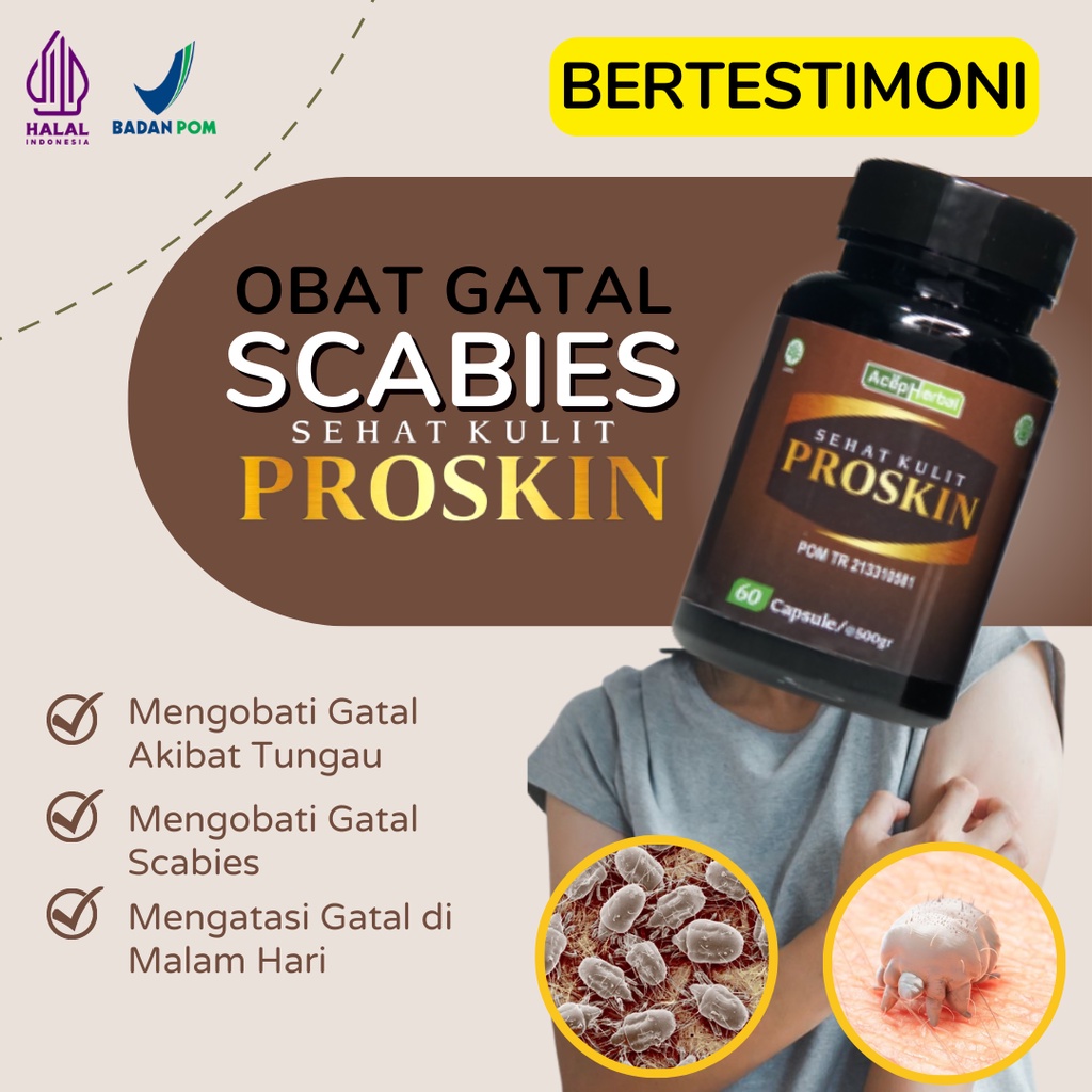 Jual Obat Kulit Scabies Infeksi Tungau Sarcoptes Scabiei Gatal Akibat ...