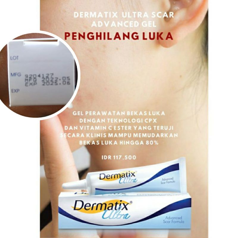 Jual [Dermatix Ultra] Cream Penghilang Bekas Luka Operasi Iris Tergores Digigit Nyamuk/Perawatan ...