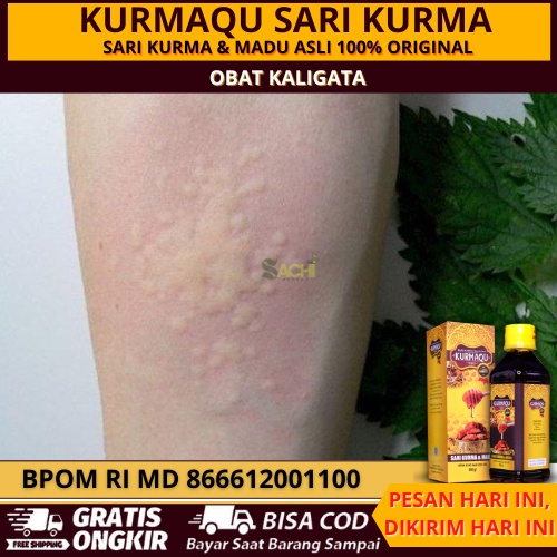 Jual Obat Kaligata, Obat Gatal Kulit Alergi, Alergi Dingin, Obat ...