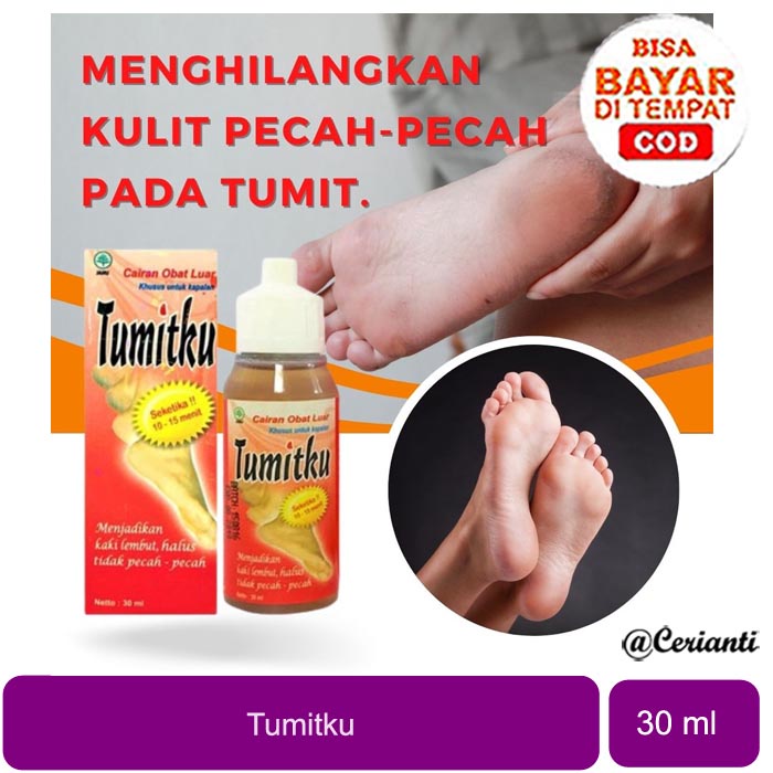 Jual Tumitku BPOM TUMITKU MENGATASI KAKI PECAH KAPALAN DENGAN CEPAT ...