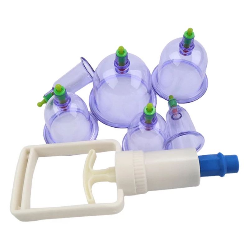 Jual Alat Bekam 1 Set Pompa + Kop Angin 6 Pcs - Terapi Tradisional | Shopee Indonesia