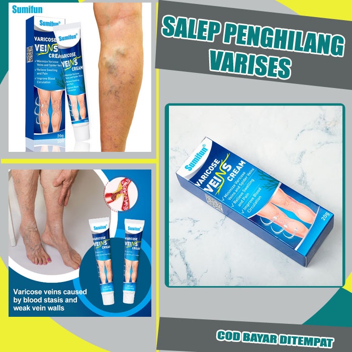 Jual JM Salep Varises Cream Varicose Veins Obat Varises Kemaluan ...