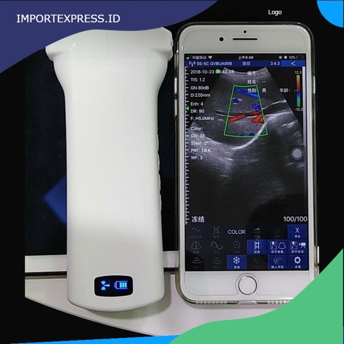 Jual GT Alat Usg Hewan Wireless Ultrasound WIFI Android/IOS Windows ...